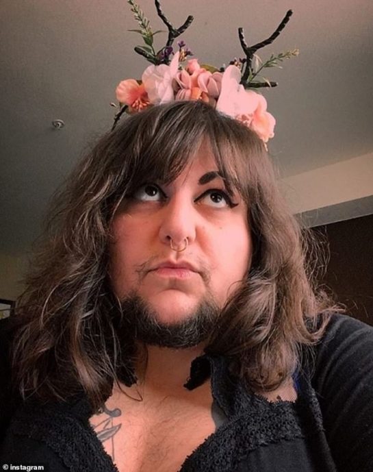 Bearded lady who feared she'd never find love reveals she's now happily ...