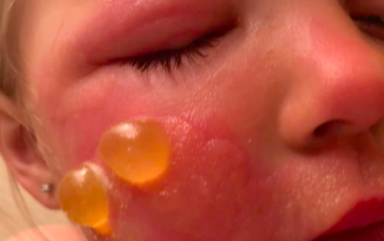 Parents warn others after little girl is covered in blisters caused by ...